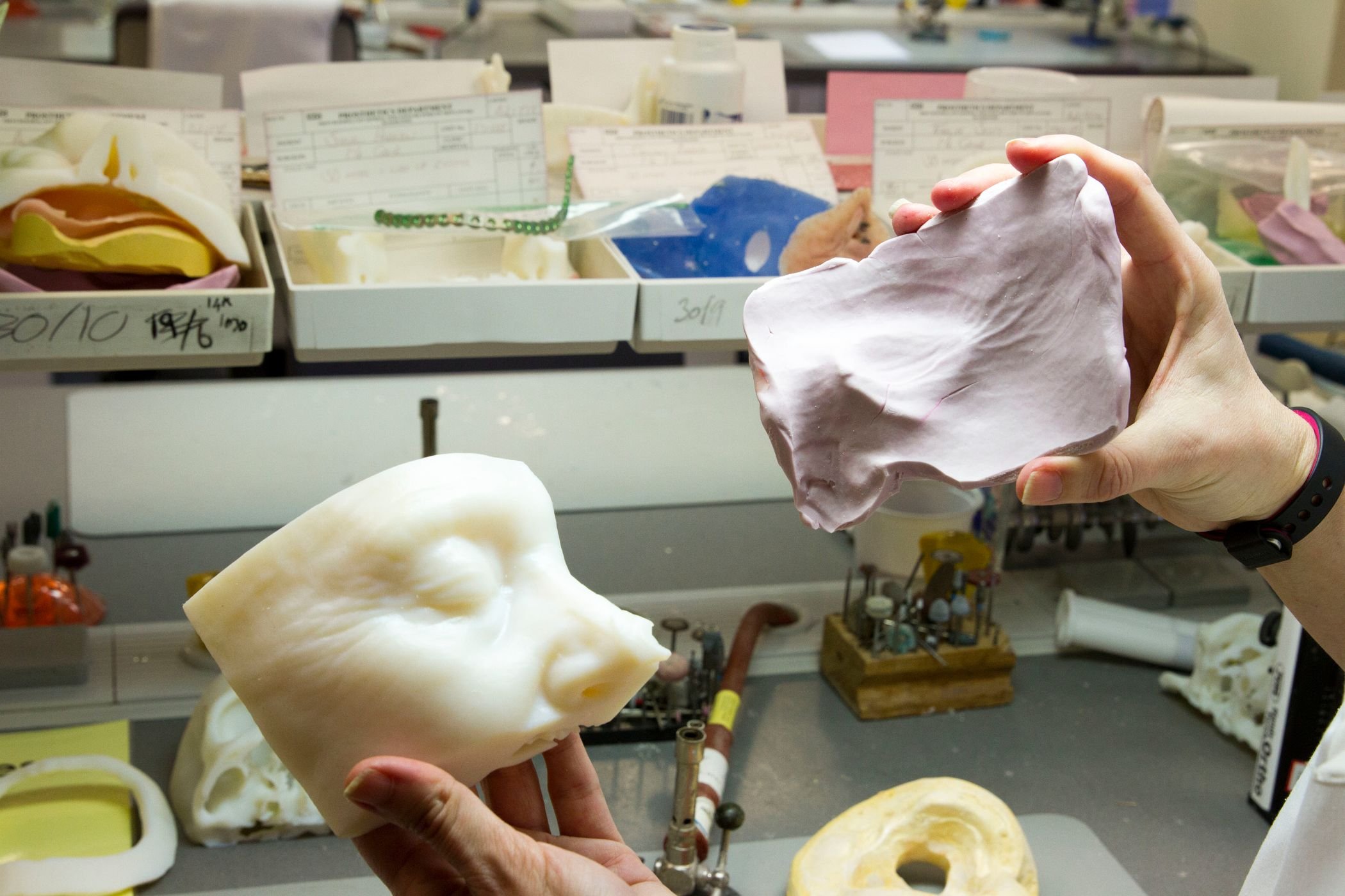 3D Planning and Printing in the NHS | HETT Insights